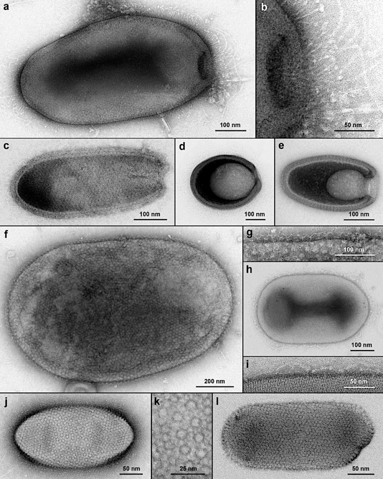 Amazing Structural Diversity Of Giant Virus-like Particles In Forest ...